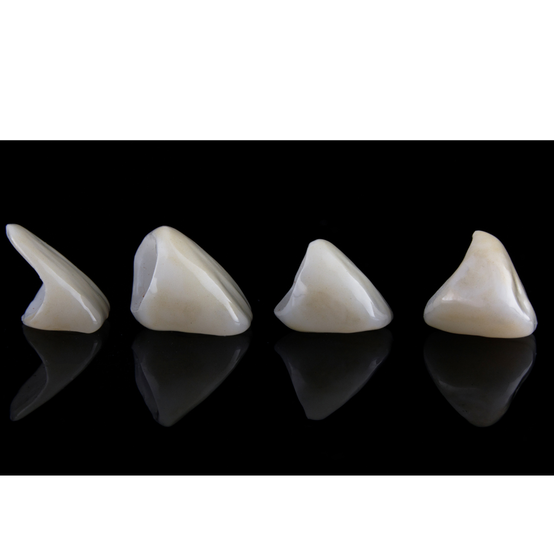 What Are Composite Veneers White Density