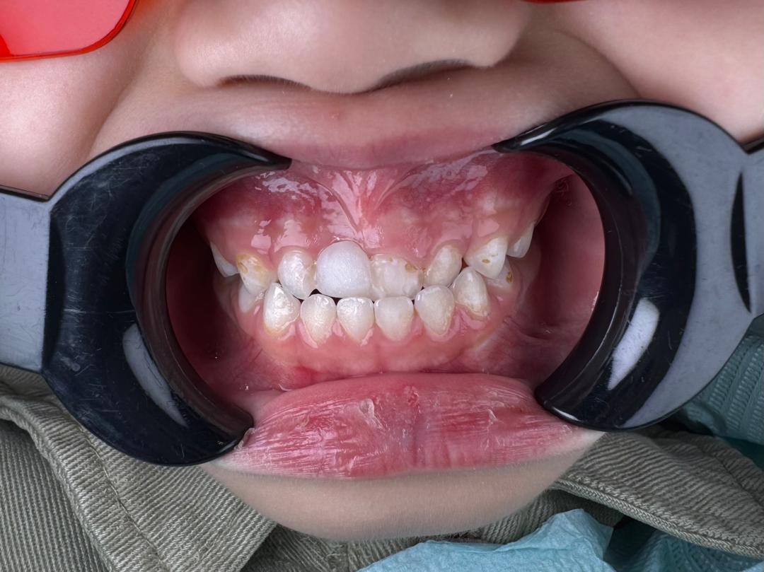 When Accidents Happen: A Brave Little Girl’s Journey After Dental ...